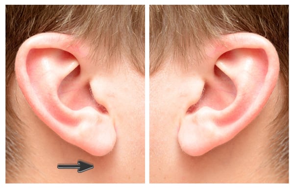How to Paint a Realistic Ear in Adobe Photoshop | Envato Tuts+